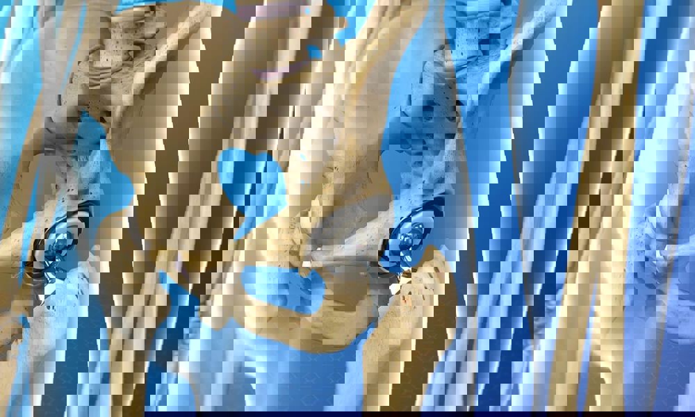 Kalça Protezi Çeşitleri - Prof. Dr. Hasan Hilmi Muratlı